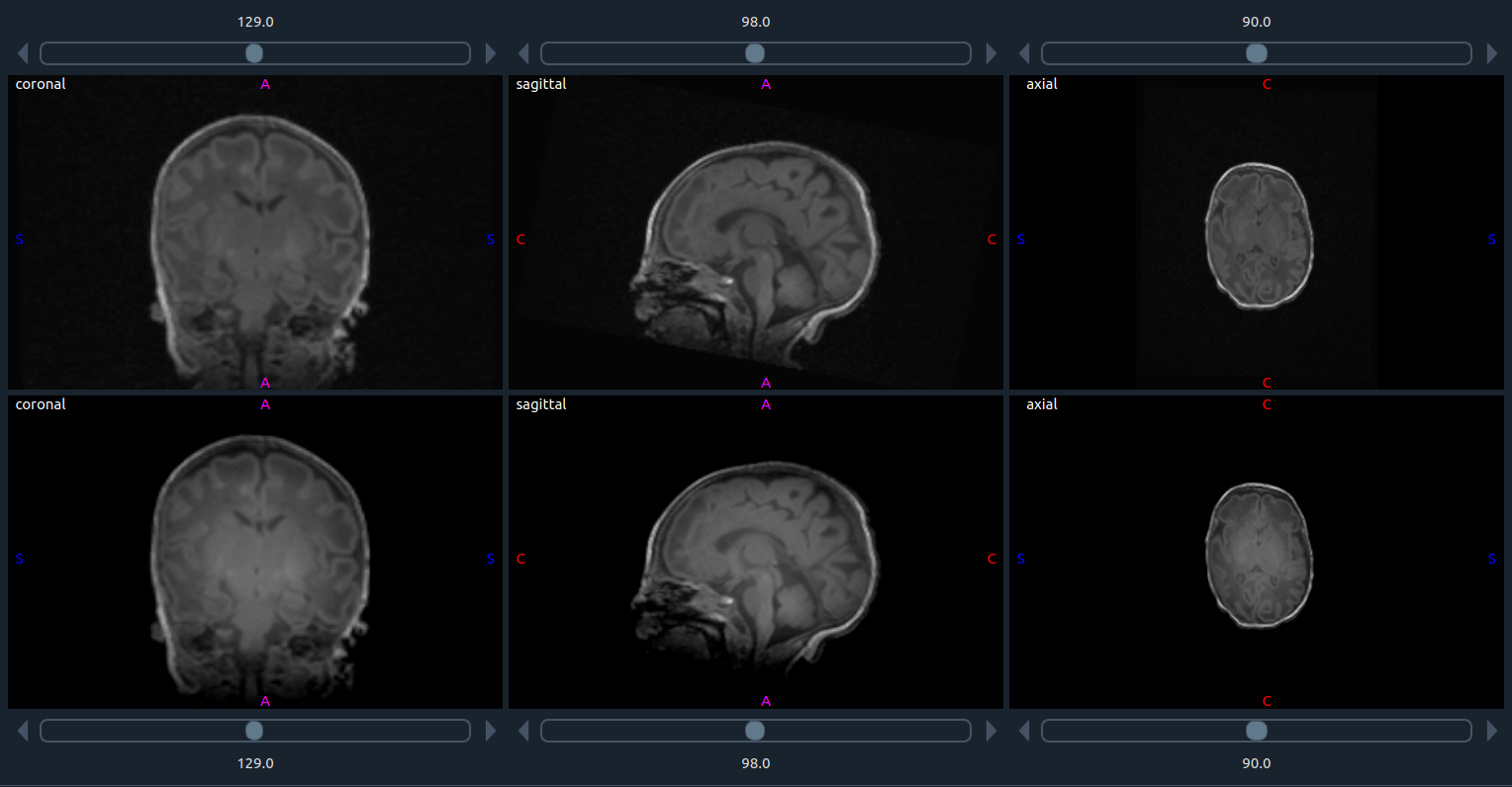 [2309.07175] MELAGE: A purely python based Neuroimaging software (Neonatal)