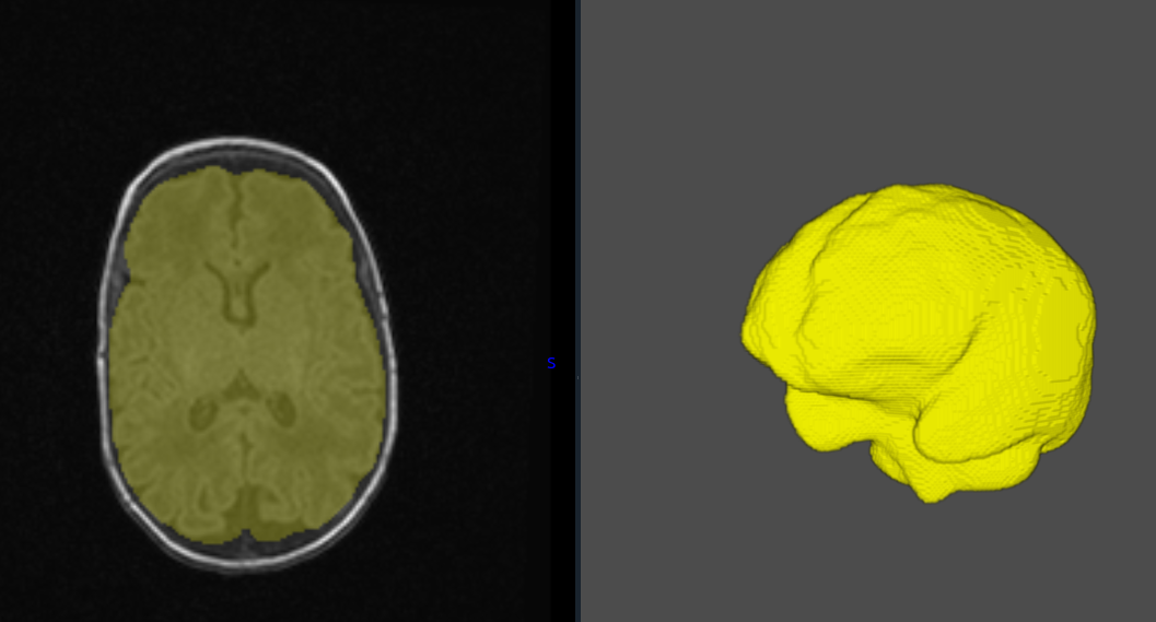 [2309.07175] MELAGE: A purely python based Neuroimaging software (Neonatal)