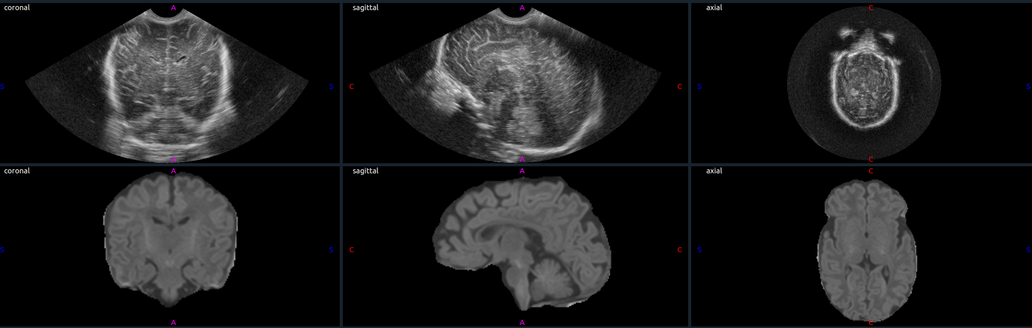 [2309.07175] MELAGE: A purely python based Neuroimaging software (Neonatal)