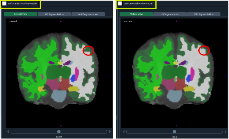 [2309.07175] MELAGE: A purely python based Neuroimaging software (Neonatal)