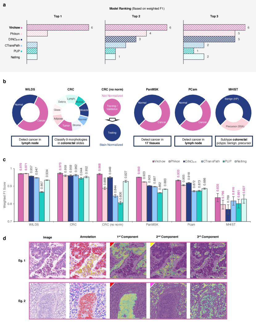 [2309.07778] Virchow: A Million-Slide Digital Pathology Foundation Model