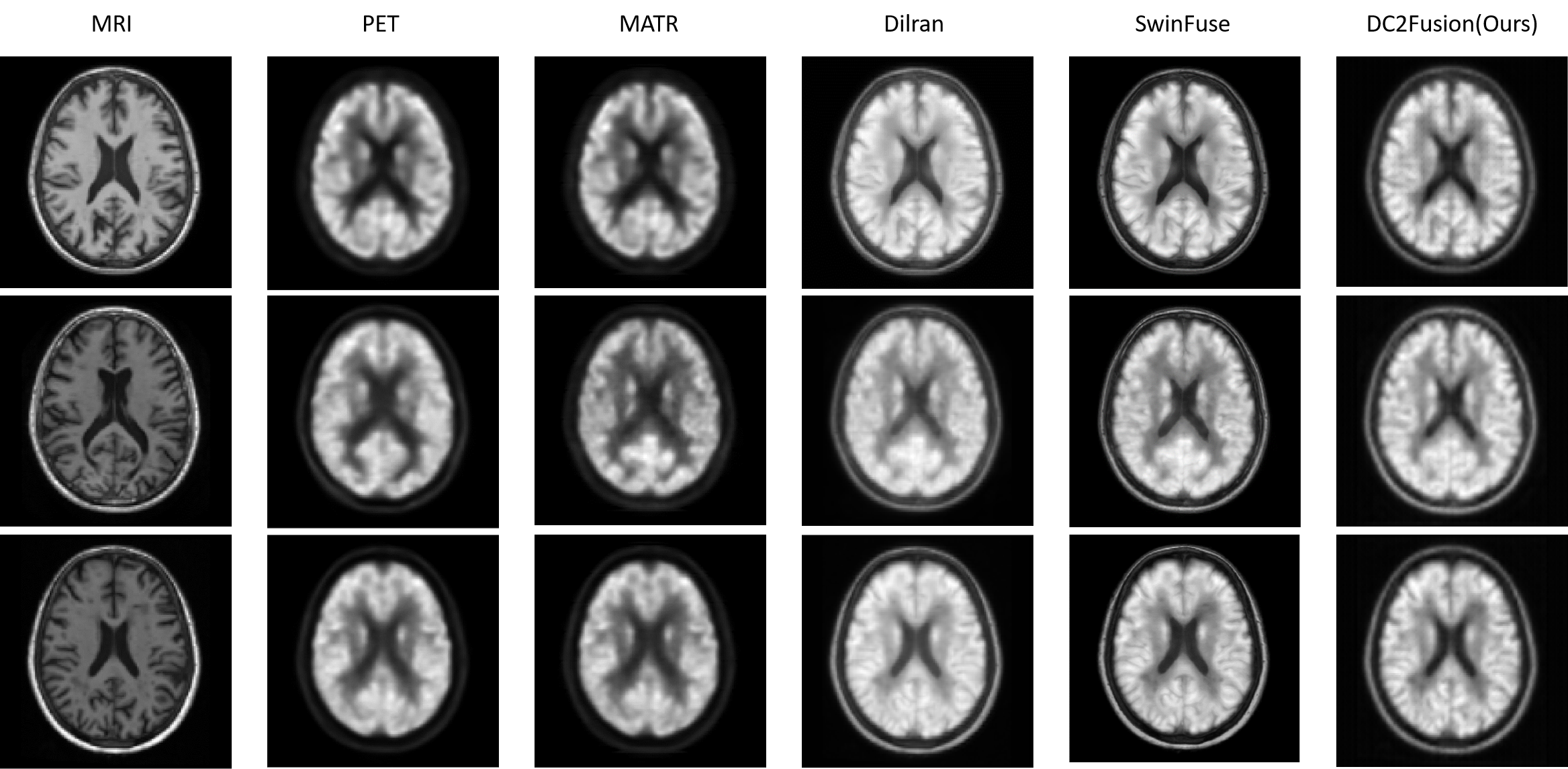[2310.06291] Three-Dimensional Medical Image Fusion with Deformable ...