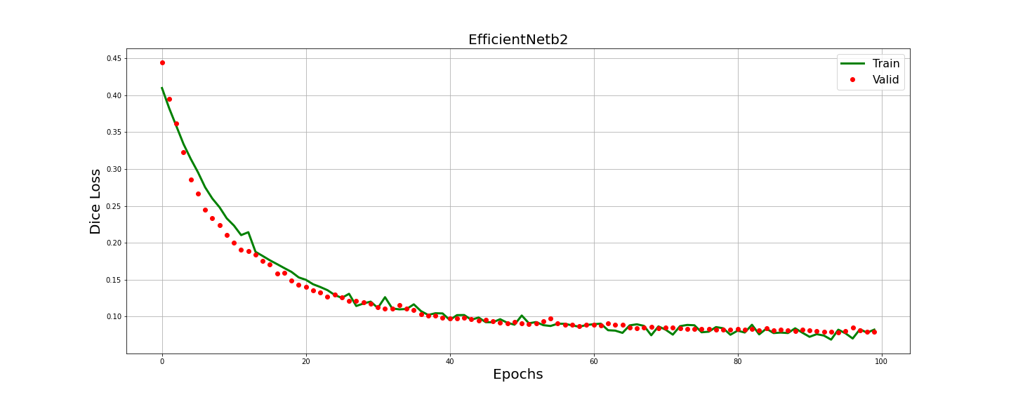 [2310.06847] Performance Analysis of Various EfficientNet Based U-Net++ Architecture for ...