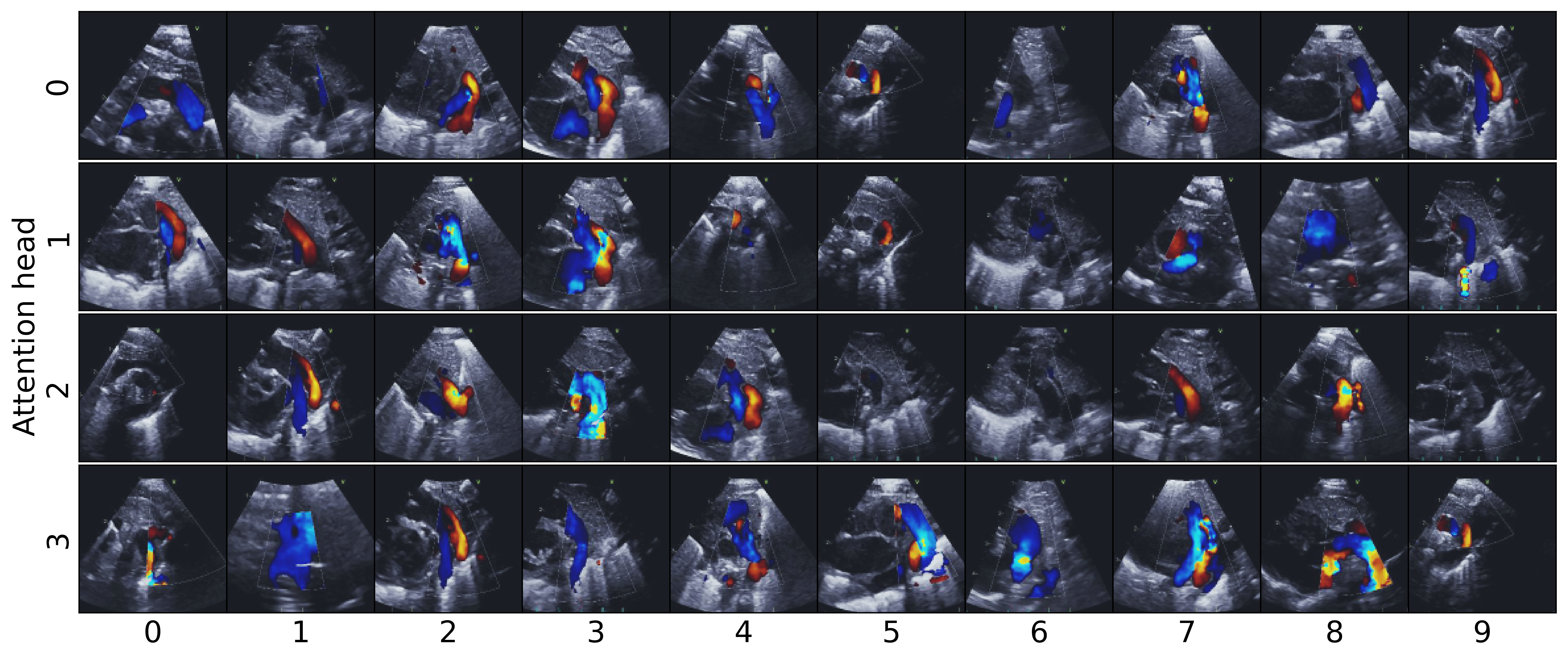 [2310.10453] On the Relevance of Temporal Features for Medical ...
