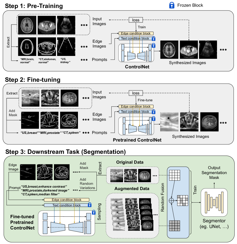 [2310.12868] EMIT-Diff: Enhancing Medical Image Segmentation via Text ...