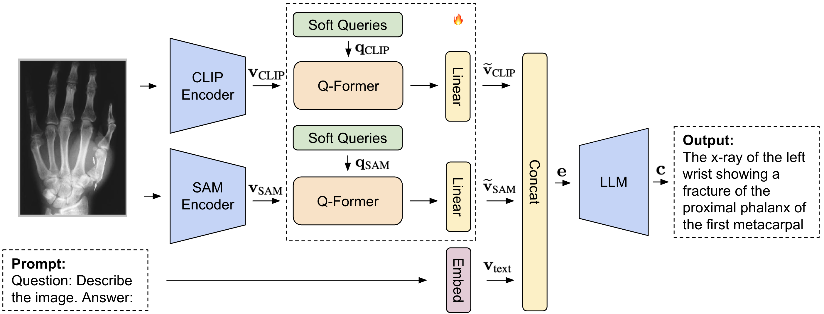[2311.01004] SAM-guided Enhanced Fine-grained Encoding with Mixed Semantic Learning for Medical ...