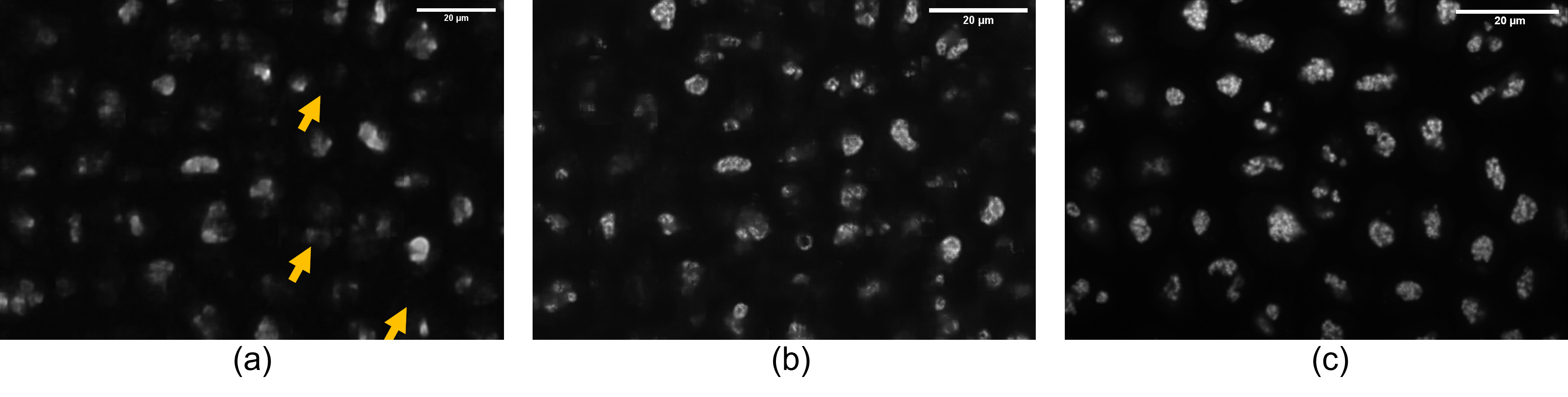 [2311.01352] Deep learning based Image Compression for Microscopy ...