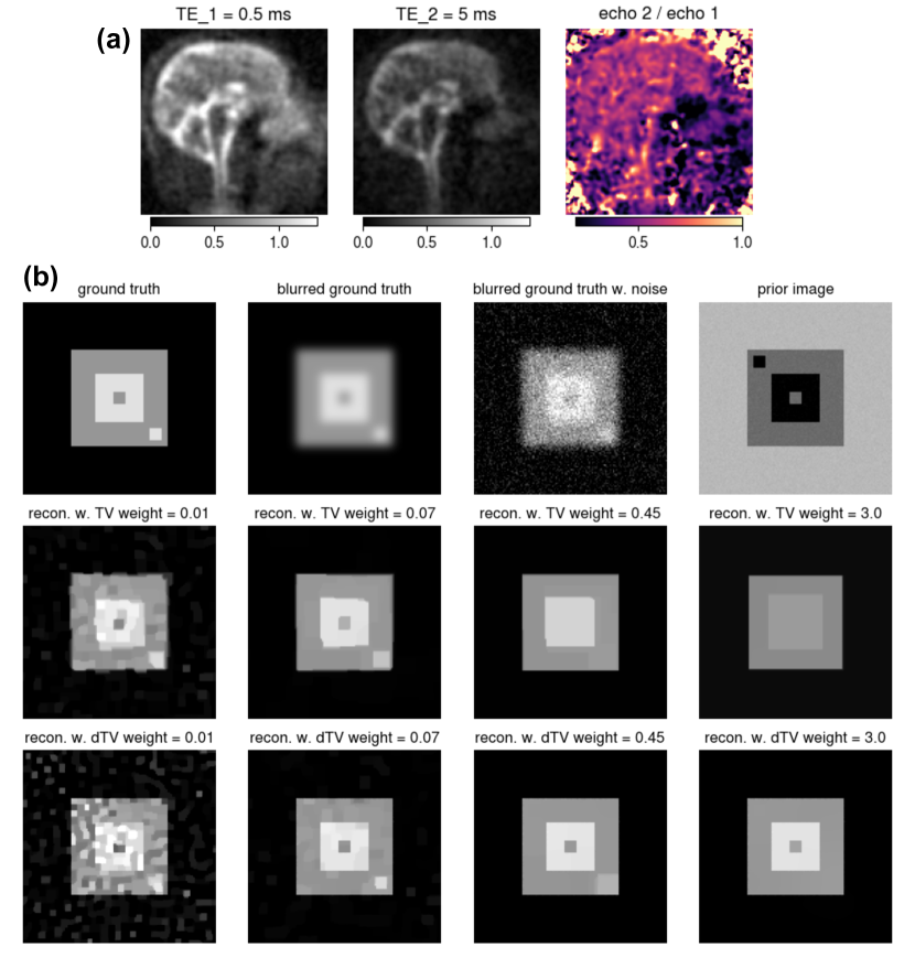 [2311.03116] Resolution enhancement, noise suppression, and joint T2* decay estimation in dual ...