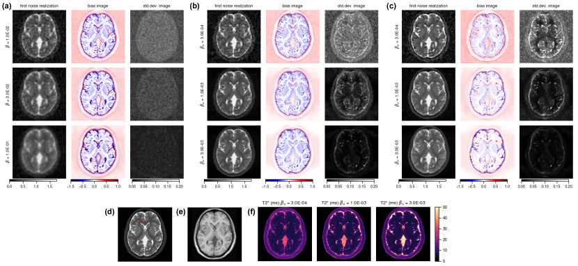 [2311.03116] Resolution enhancement, noise suppression, and joint T2* decay estimation in dual ...