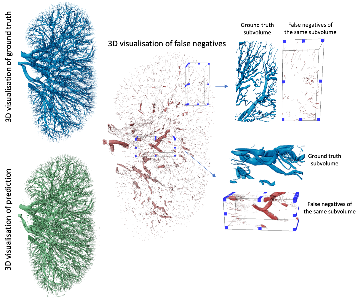 [2311.13319] Deep Learning for Vascular Segmentation and Applications ...