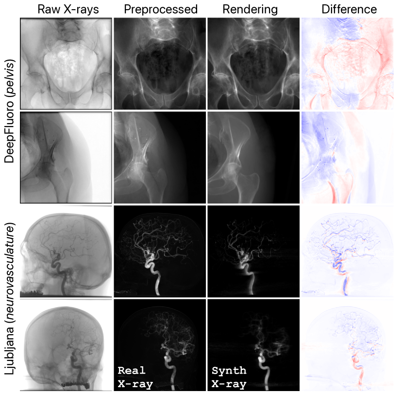 [2312.06358] Intraoperative 2D/3D Image Registration via Differentiable ...