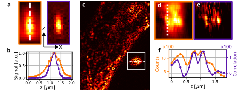 [2401.00261] Robust fluctuation-based super-resolution microscopy in a ...
