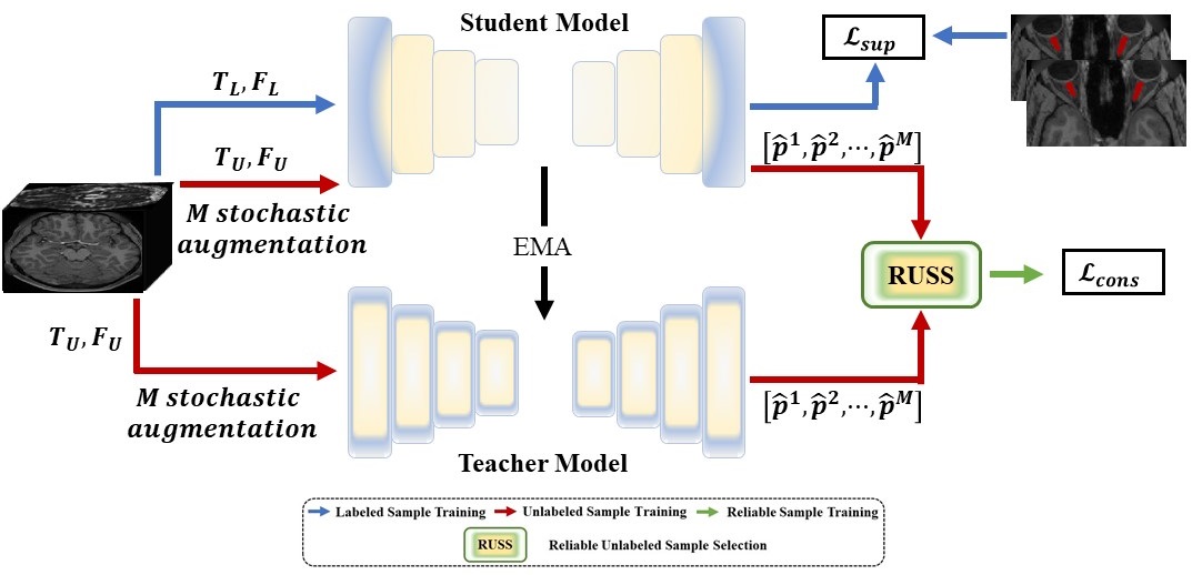 [2401.01654] LESEN: Label-Efficient deep learning for Multi-parametric ...
