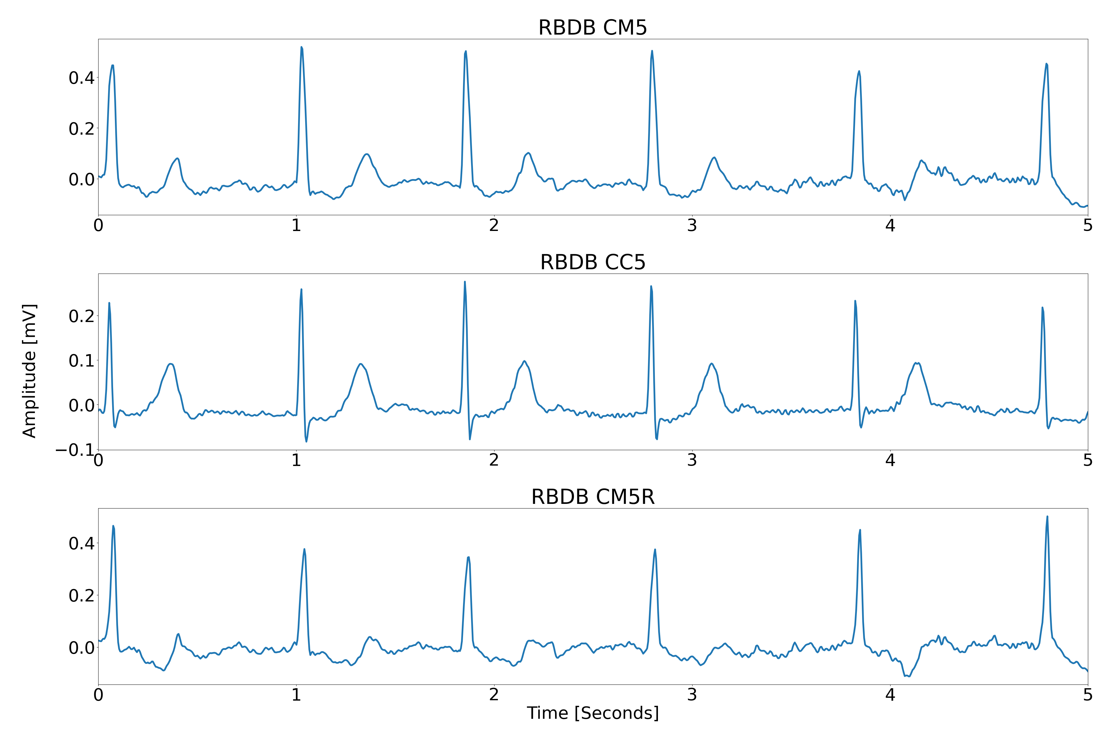 [2401.05411] RawECGNet: Deep Learning Generalization for Atrial Fibrillation Detection from the ...