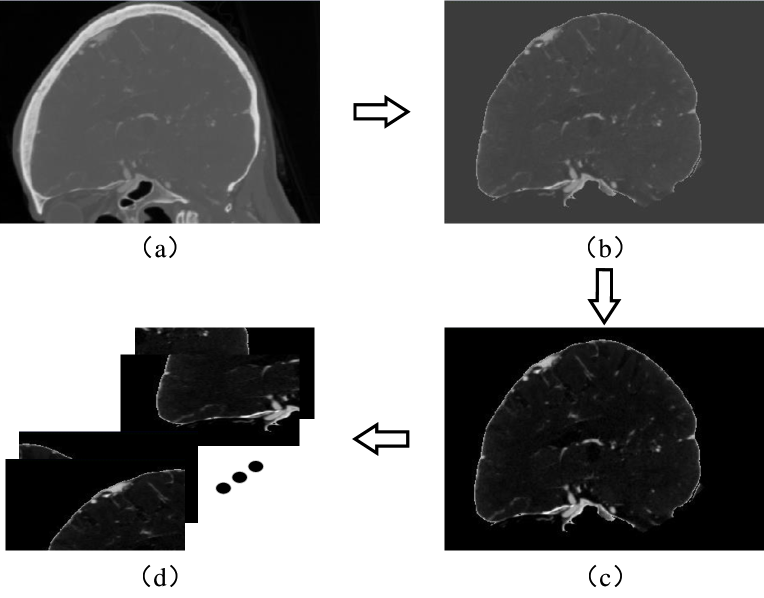 [2401.07041] An automated framework for brain vessel centerline ...