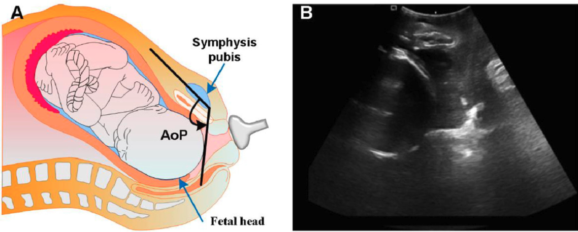 [2401.15513] MiTU-Net: A fine-tuned U-Net with SegFormer backbone for ...