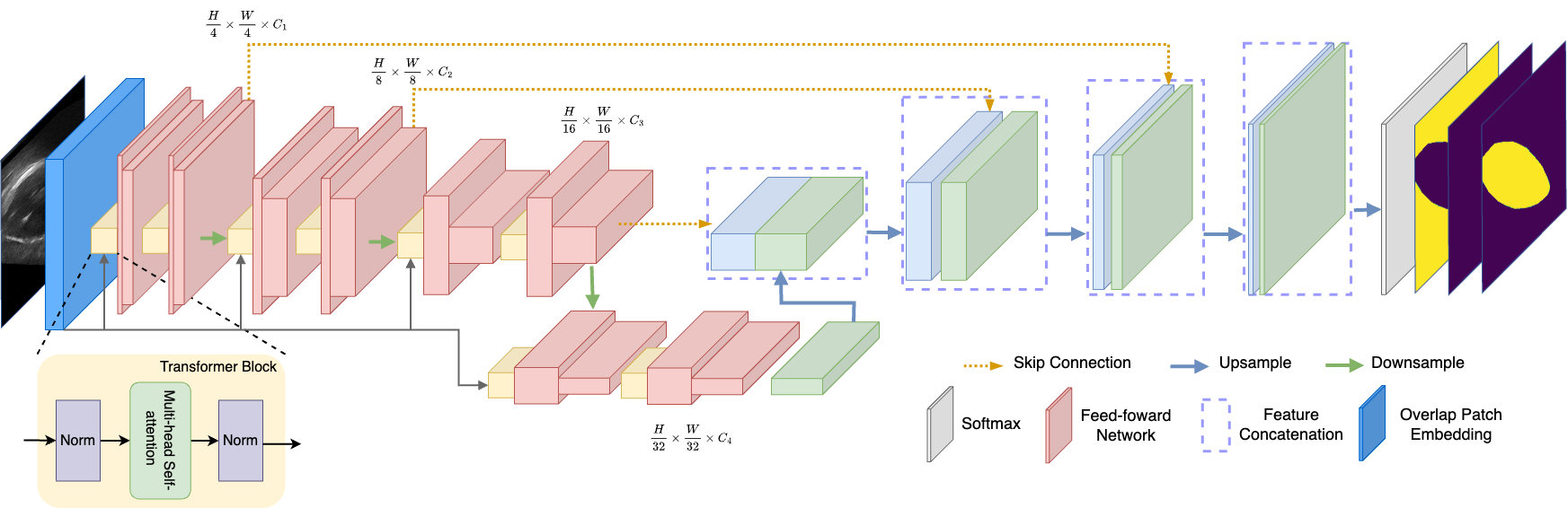 [2401.15513] MiTU-Net: A fine-tuned U-Net with SegFormer backbone for ...