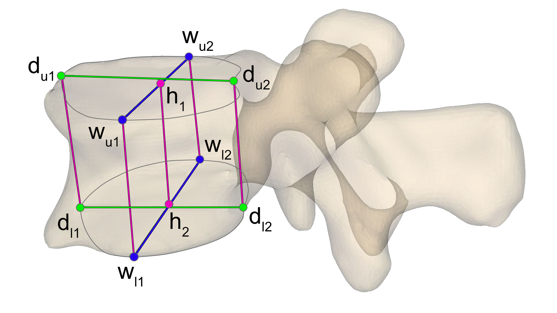 [2402.01462] 3D Vertebrae Measurements: Assessing Vertebral Dimensions ...