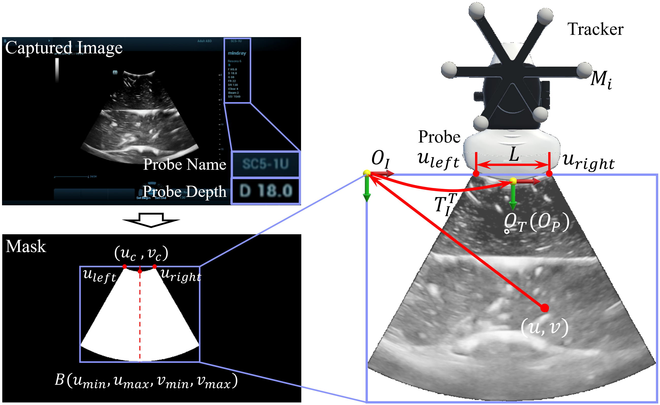 [2402.02414] Navigate Biopsy with Ultrasound under Augmented Reality ...