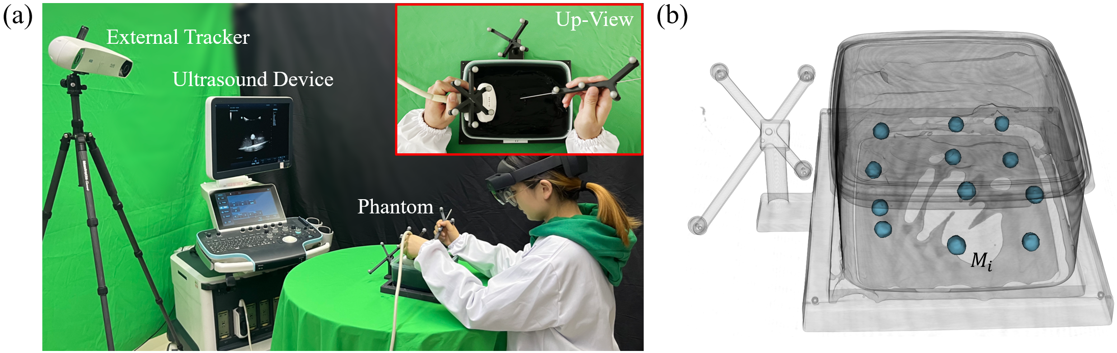 [2402.02414] Navigate Biopsy with Ultrasound under Augmented Reality ...