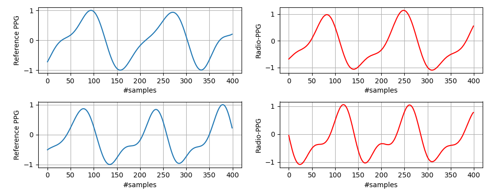 [2402.14565] Non-Contact Acquisition of PPG Signal using Chest Movement ...