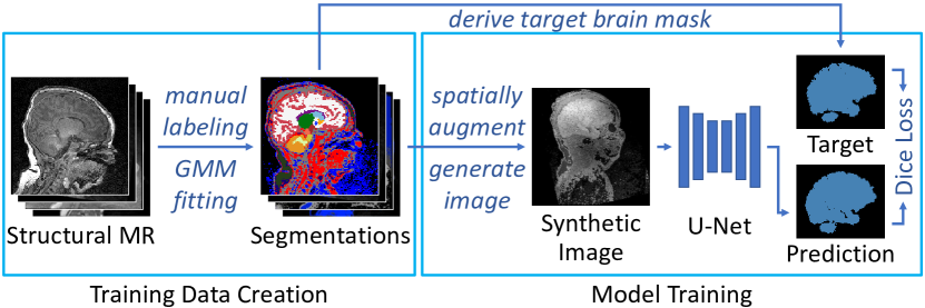 [2402.16634] Boosting skull-stripping performance for pediatric brain ...