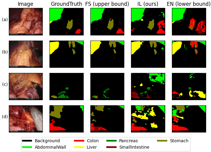 [2402.19340] One model to use them all: Training a segmentation model ...