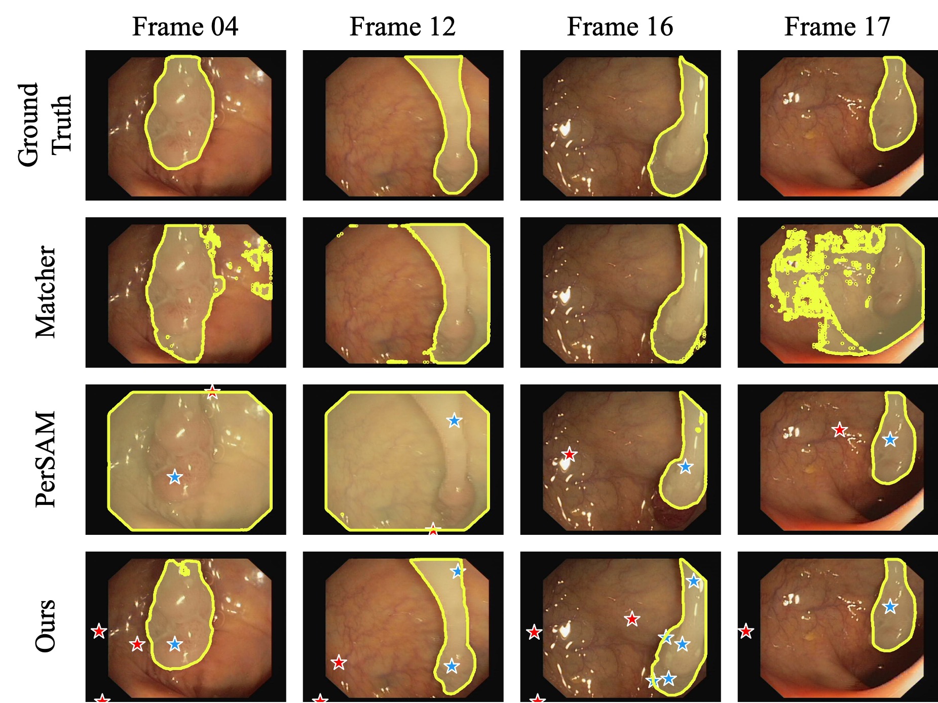 [2403.05433] Part-aware Personalized Segment Anything Model for Patient ...