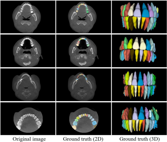 [2404.01065] T-Mamba: Frequency-Enhanced Gated Long-Range Dependency ...
