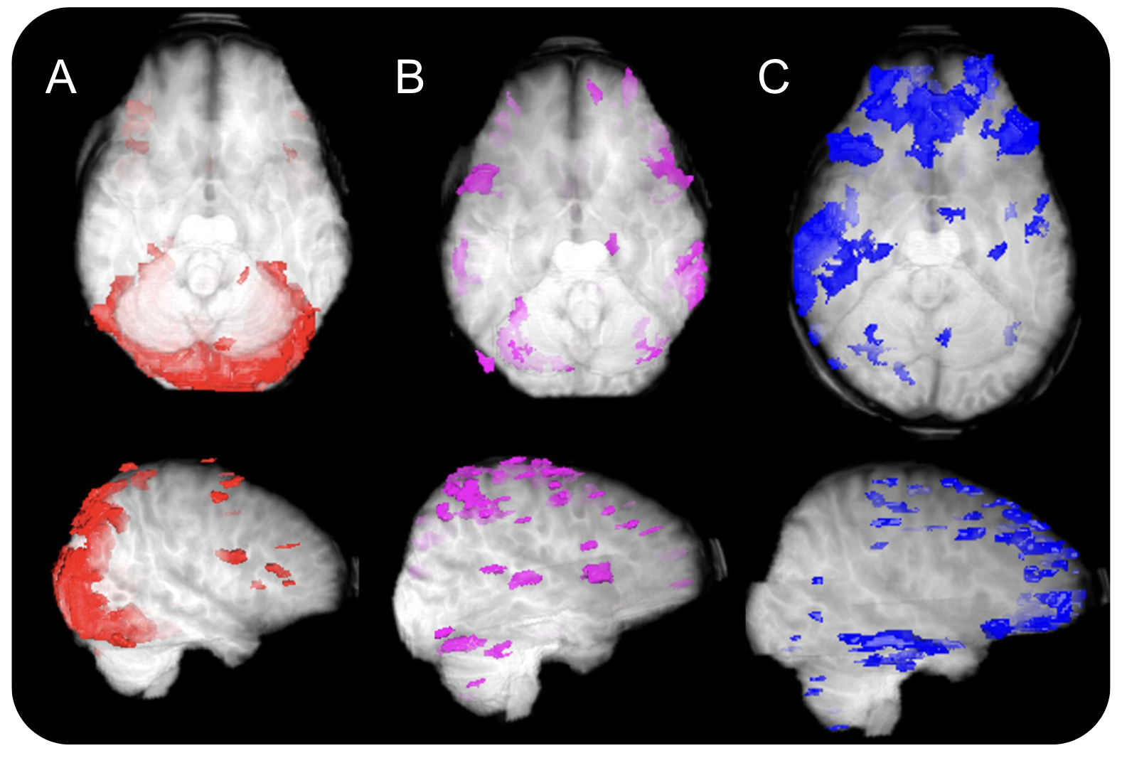 [2404.05468] Mind-to-Image: Projecting Visual Mental Imagination of the ...
