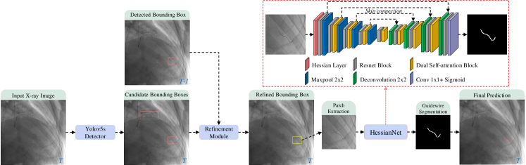 [2404.08805] Real-time guidewire tracking and segmentation in ...