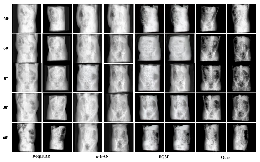 [2404.11889] Multi-view X-ray Image Synthesis with Multiple Domain ...