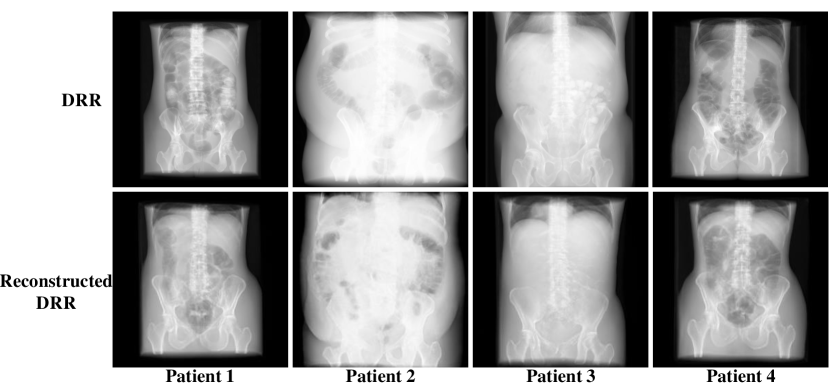 [2404.11889] Multi-view X-ray Image Synthesis with Multiple Domain ...