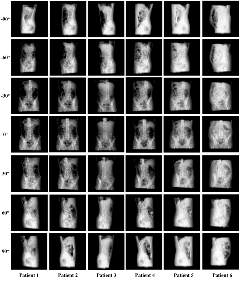 [2404.11889] Multi-view X-ray Image Synthesis with Multiple Domain ...