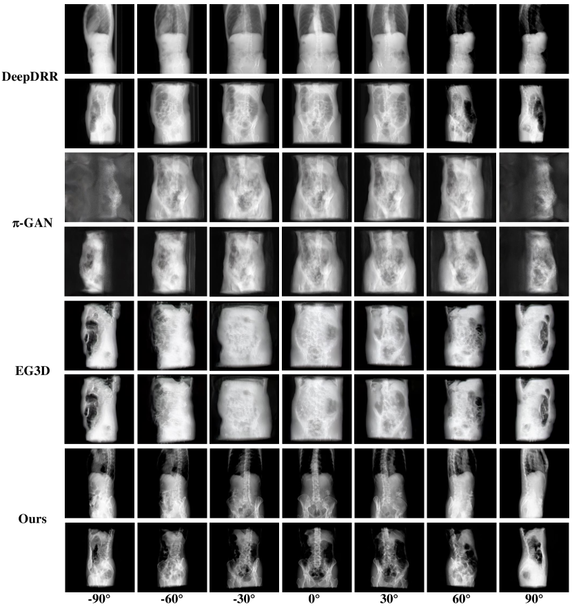 [2404.11889] Multi-view X-ray Image Synthesis with Multiple Domain ...