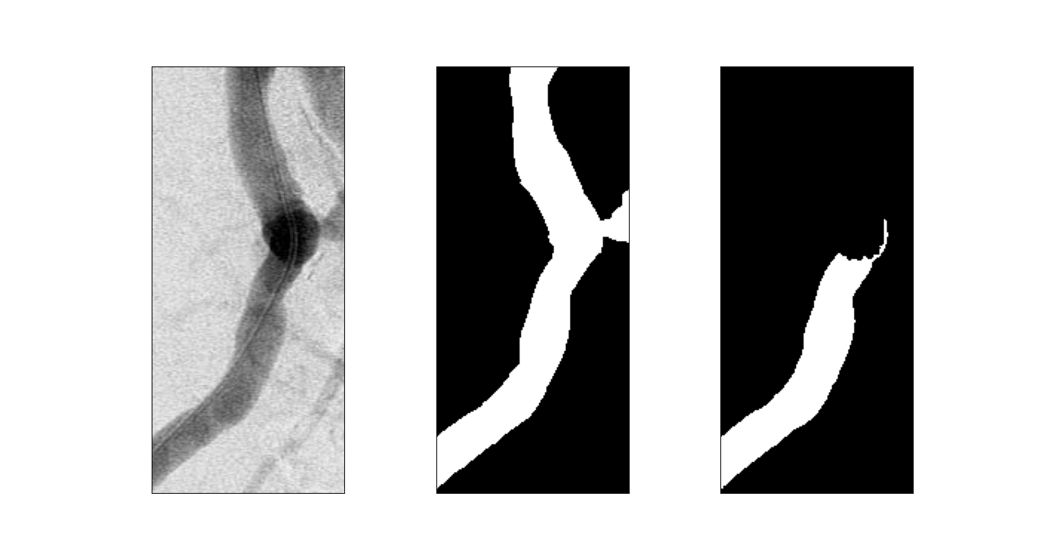 [2404.17029] Dr-SAM: An End-to-End Framework for Vascular Segmentation ...