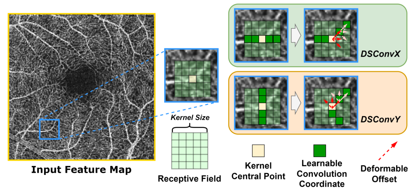 [2404.18096] Snake with Shifted Window: Learning to Adapt Vessel ...