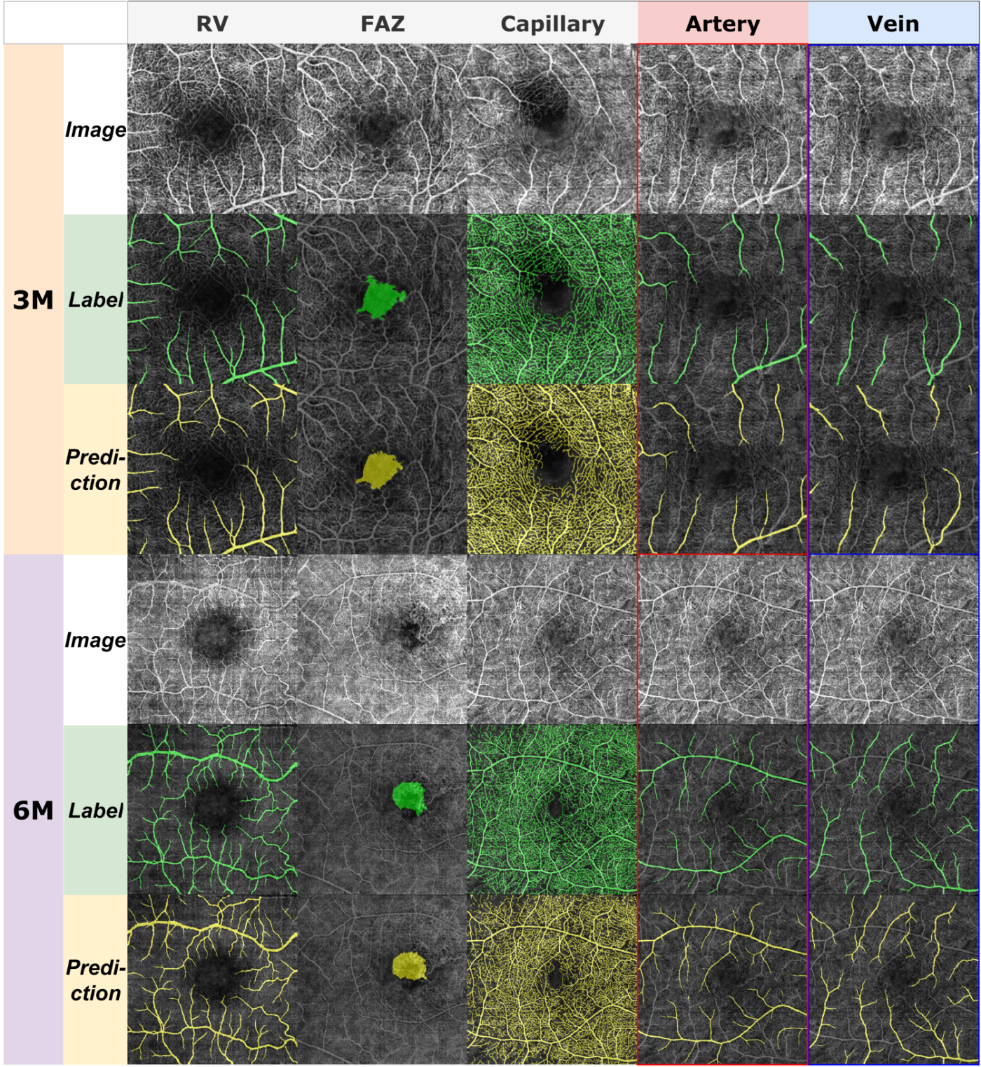 [2404.18096] Snake with Shifted Window: Learning to Adapt Vessel ...