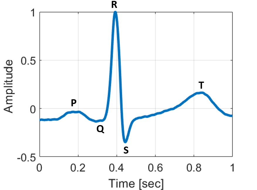 [2405.13904] ECG-TEM: Time-based sub-Nyquist sampling for ECG signal ...