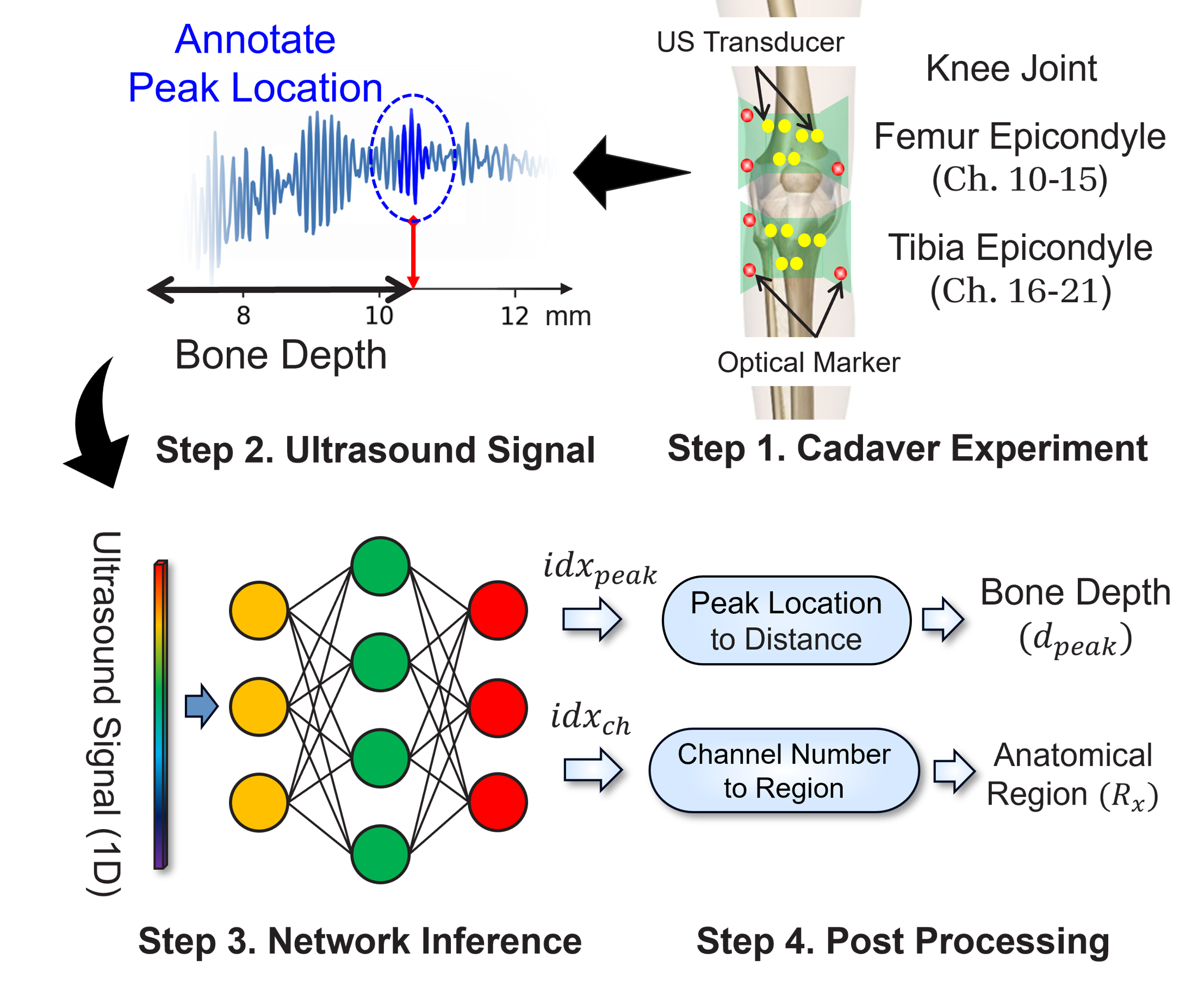 [2405.19542] Anatomical Region Recognition and Real-time Bone Tracking ...
