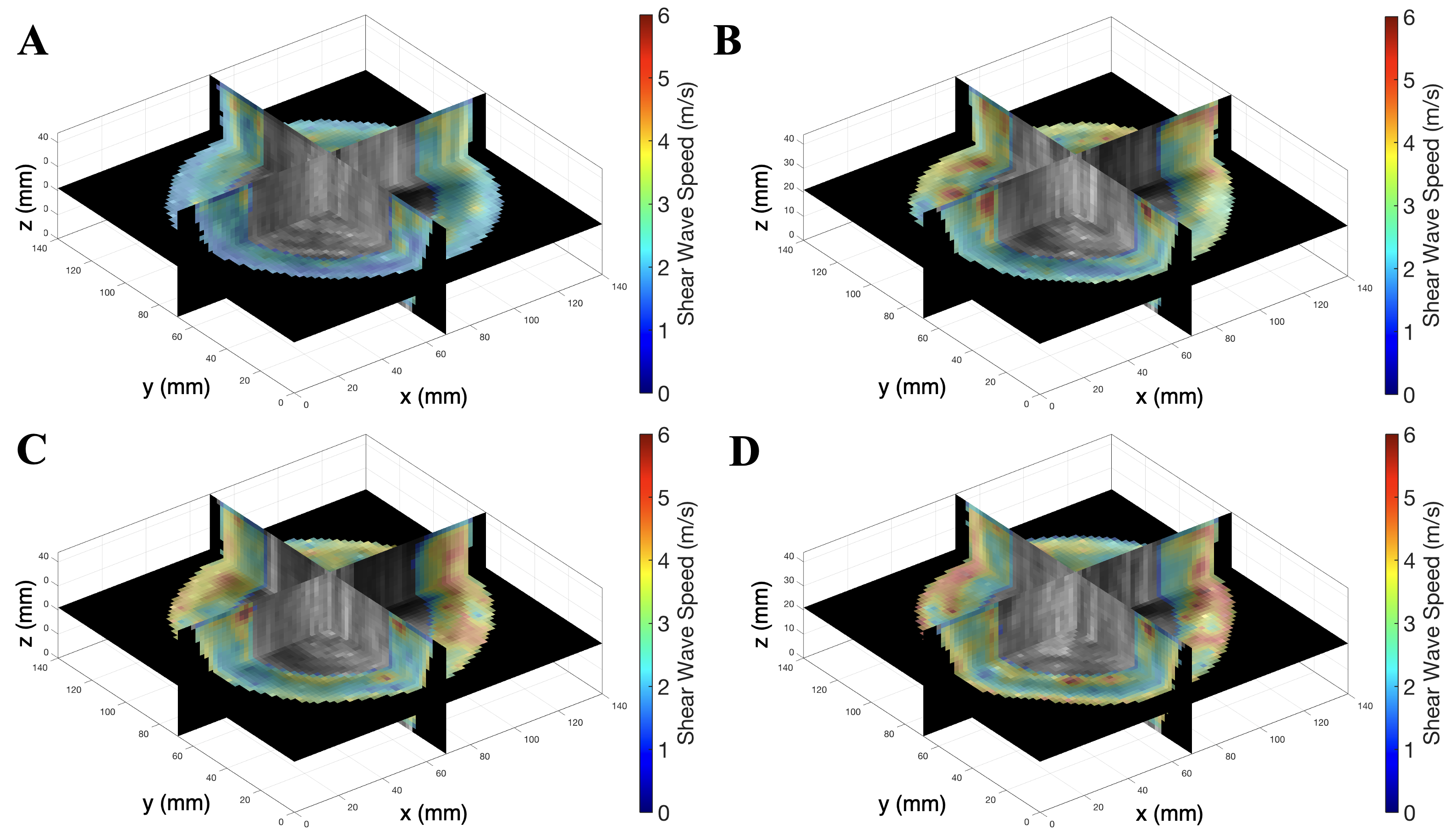 [2406.03962] 3D ultrasound shear wave elastography for musculoskeletal ...