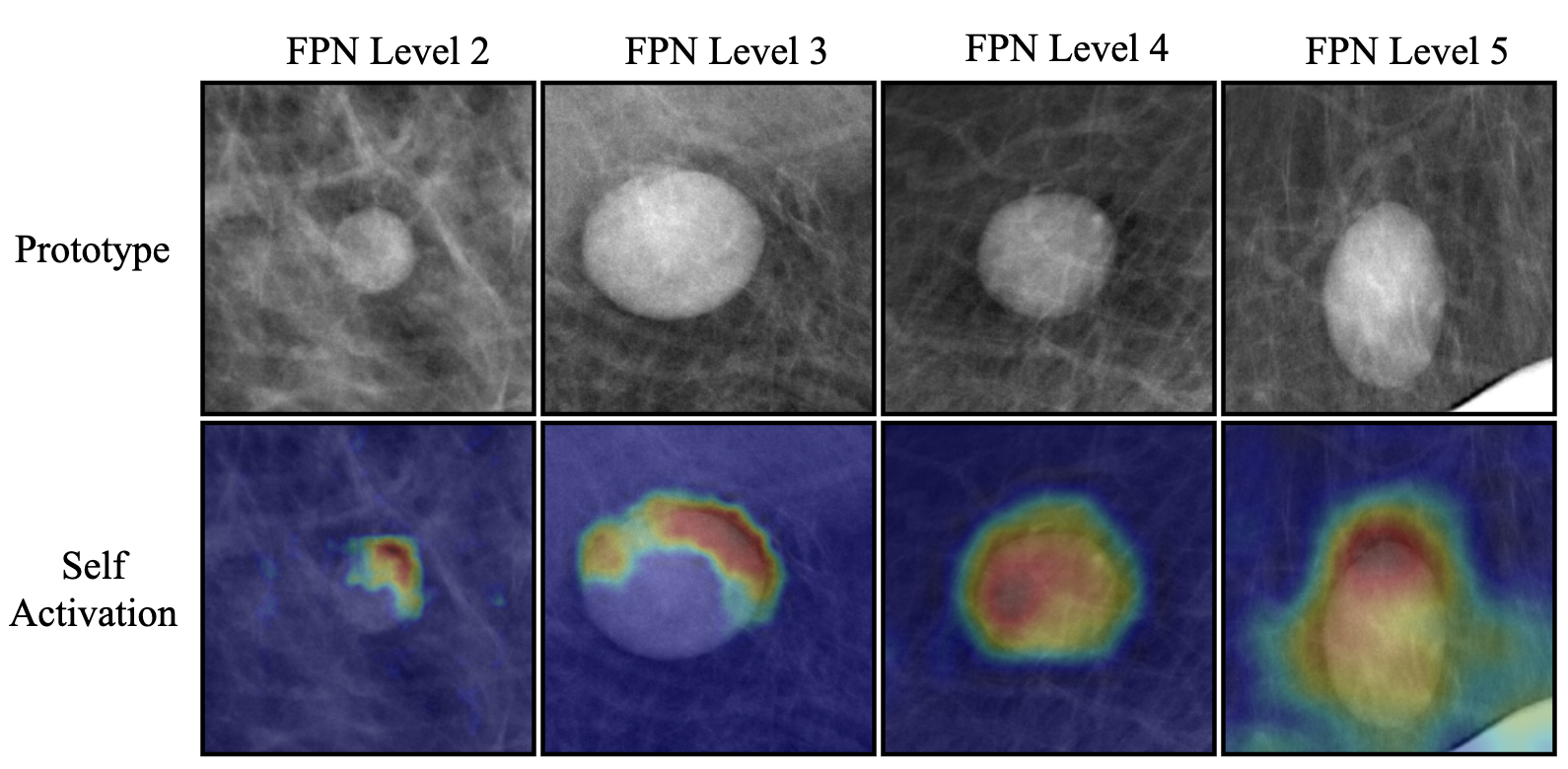 [2406.06386] FPN-IAIA-BL: A Multi-Scale Interpretable Deep Learning Model for Classification of ...
