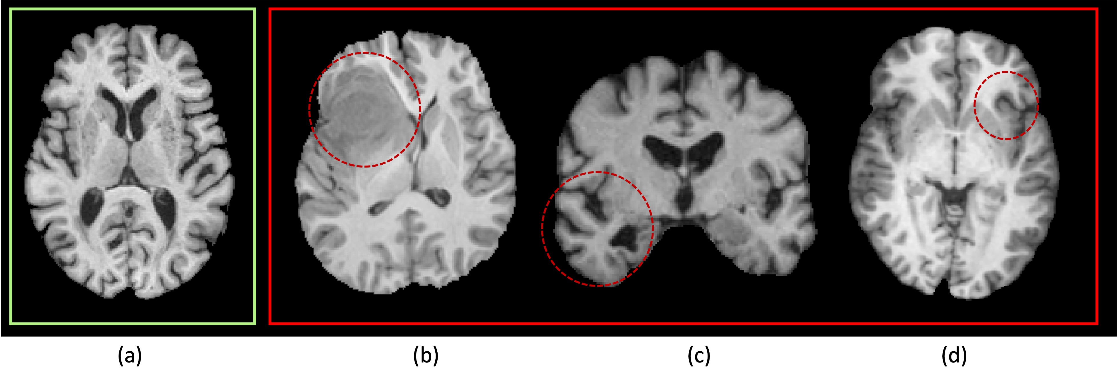 [2407.08948] Symmetry Awareness Encoded Deep Learning Framework for ...