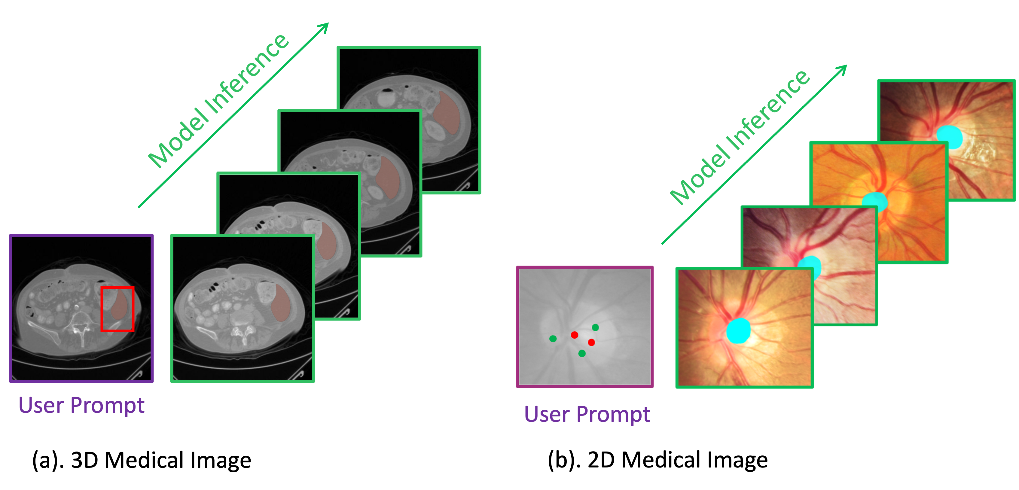 [2408.00874] Medical SAM 2: Segment medical images as video via Segment Anything Model 2