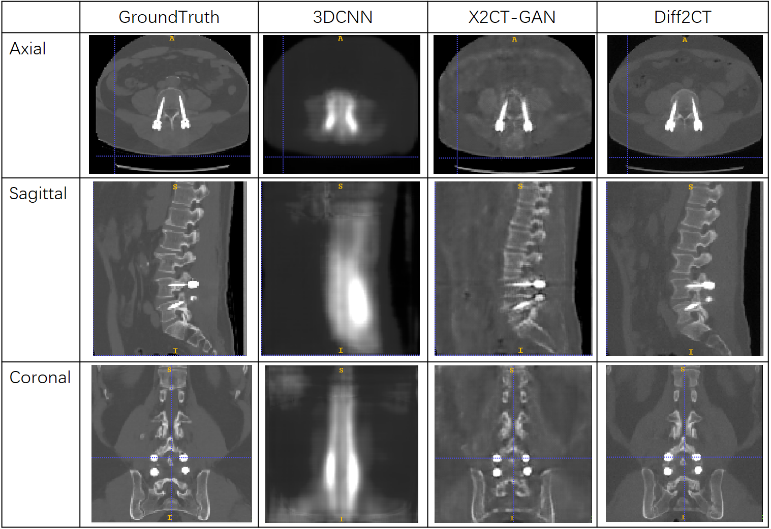 [2408.09731] Reconstruct Spine CT from Biplanar X-Rays via Diffusion ...