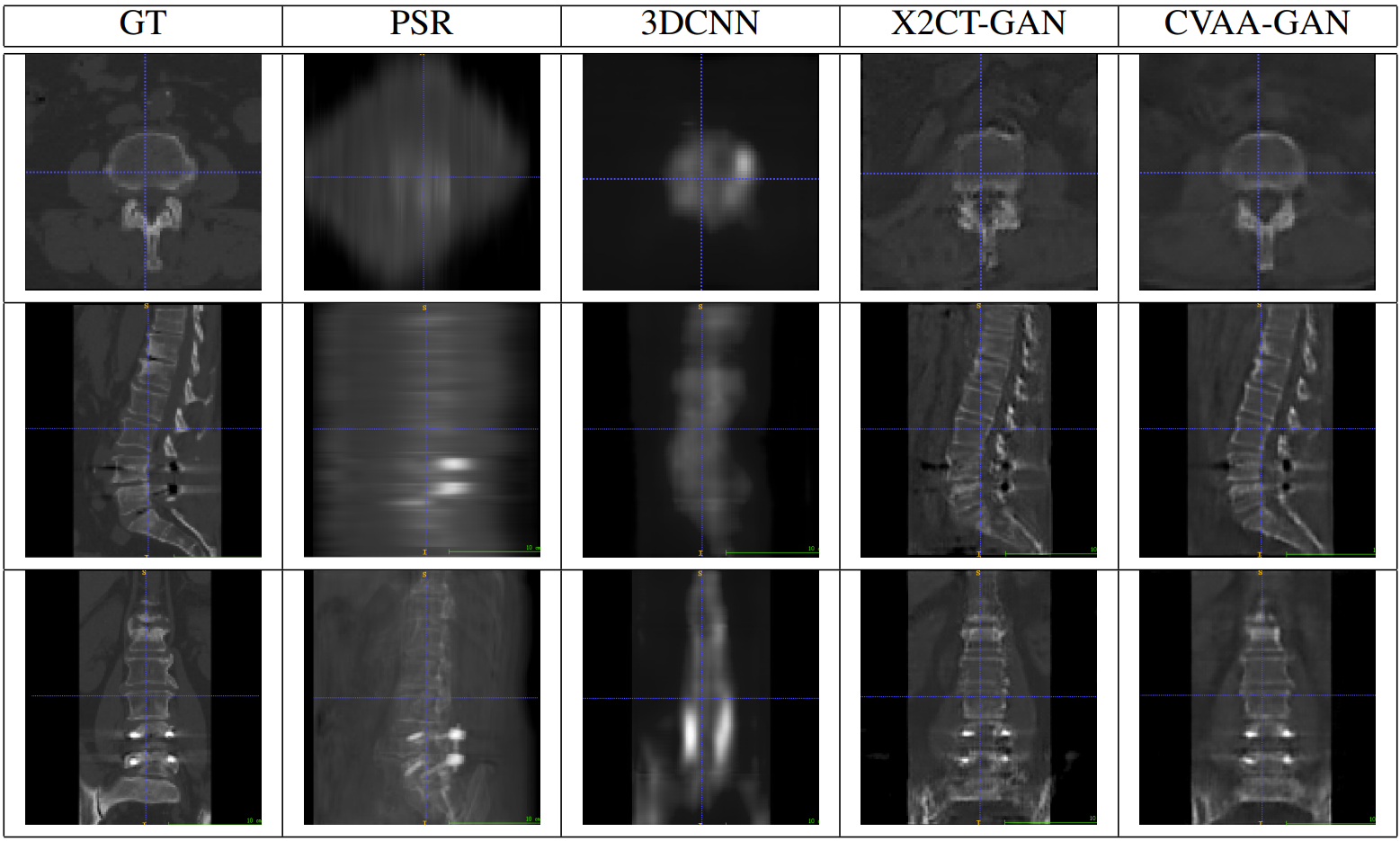 [2408.09736] Coarse-Fine View Attention Alignment-Based GAN for CT ...
