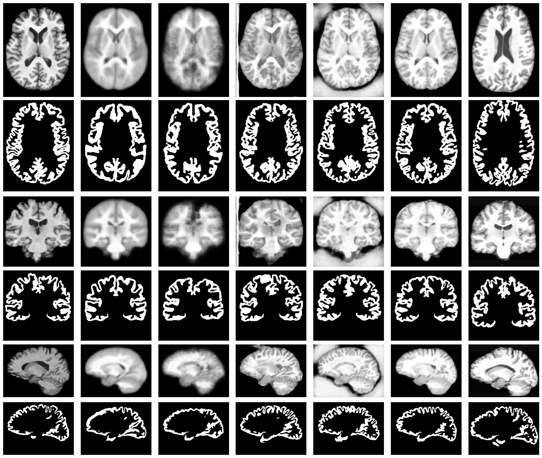 [2409.08463] Evaluating the Quality of Brain MRI Generators