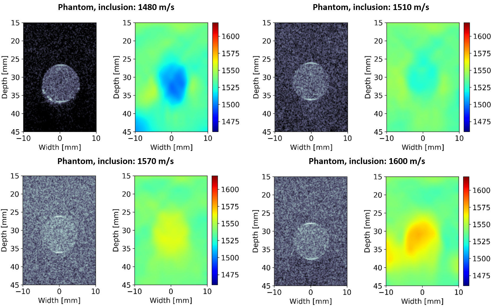 [2409.14035] Implicit Neural Representations for Speed-of-Sound ...