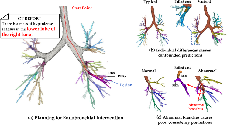 [2410.23854] Airway Labeling Meets Clinical Applications: Reflecting ...