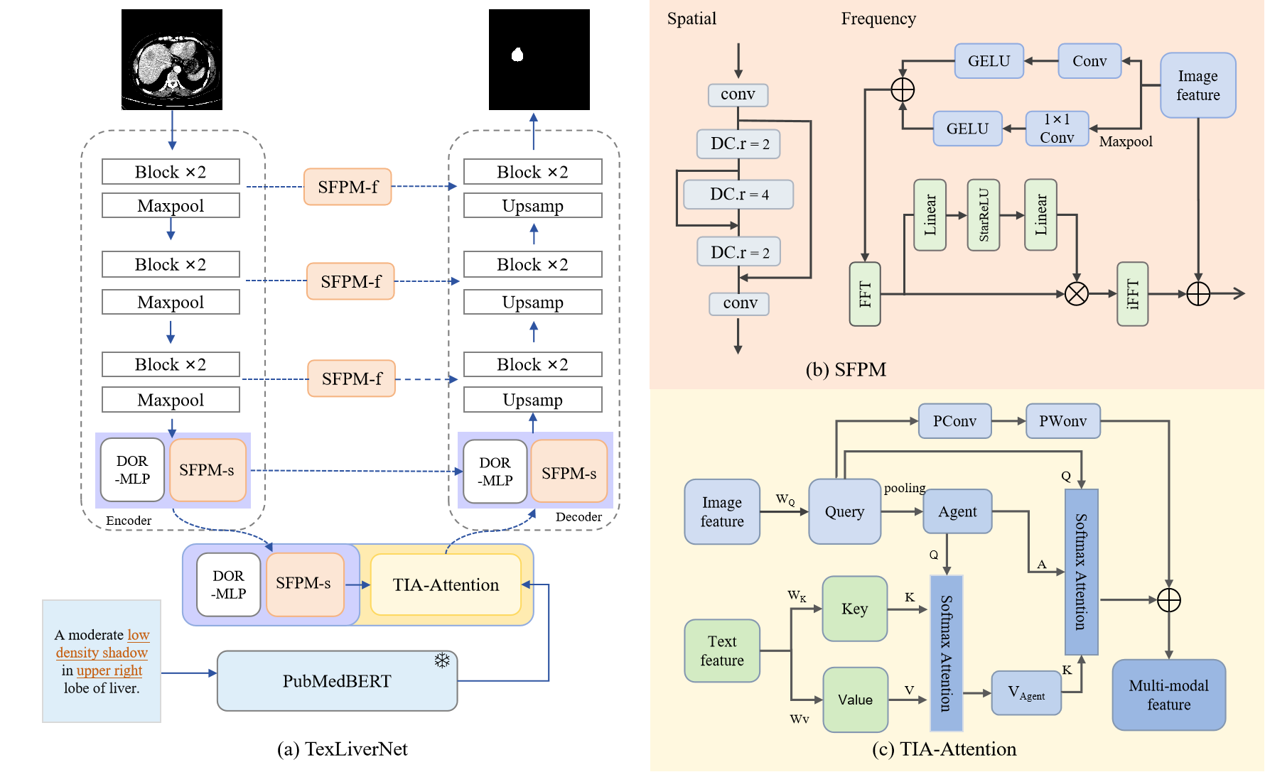 [2411.04595] TexLiverNet: Leveraging Medical Knowledge and Spatial-Frequency Perception for ...